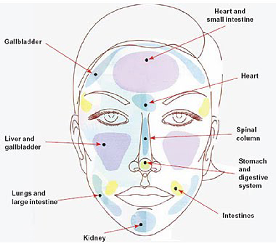 Associated Causes Of Acne Per Facial Zone Associated Causes Of Acne Per Facial Zone